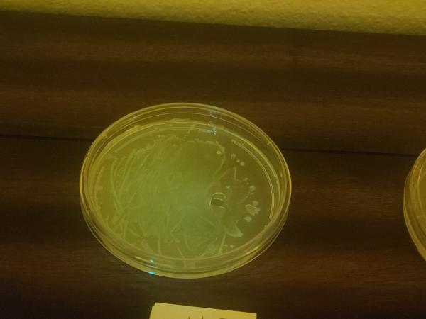 GFP Bacteria