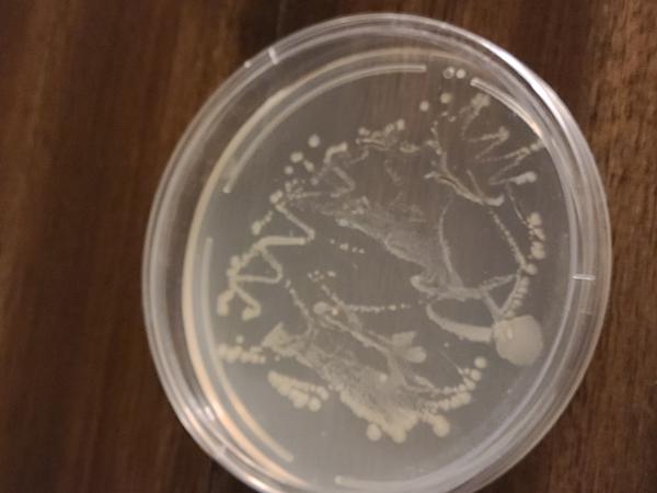 GFP Bacteria